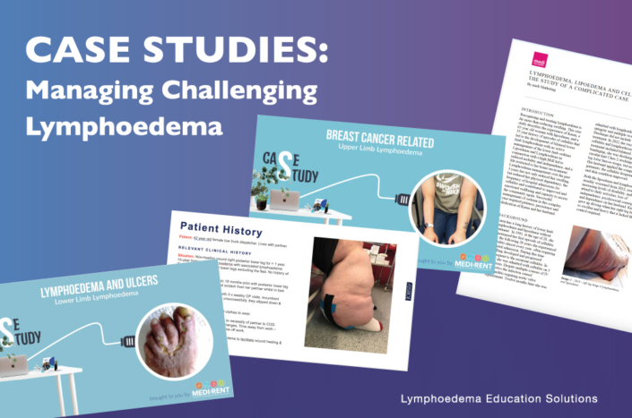 Managing Challenging Lymphoedema - Lymphoedema Education Solutions